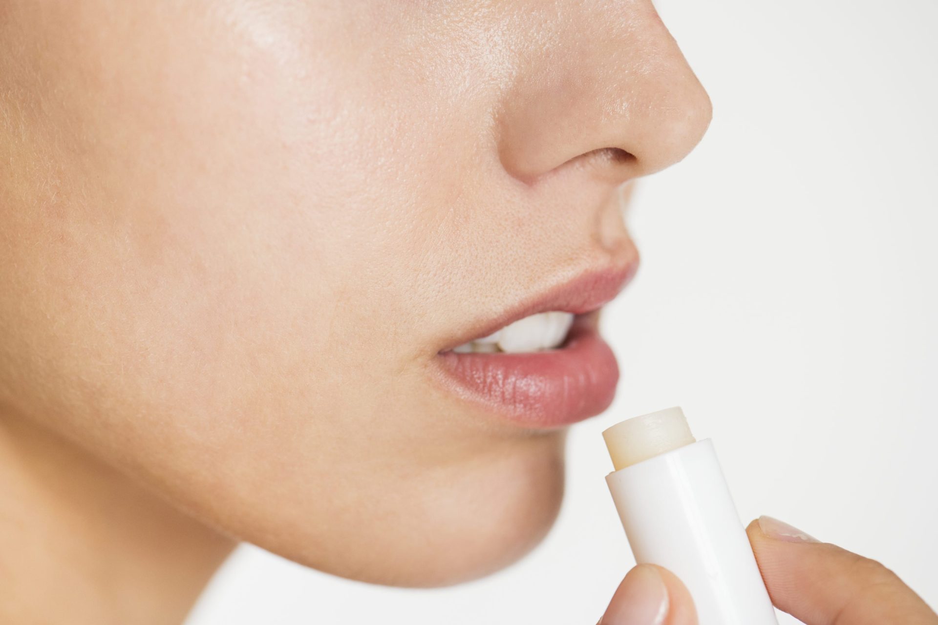 10 Causes Of Dry, Cracked Lips And How To Heal Them