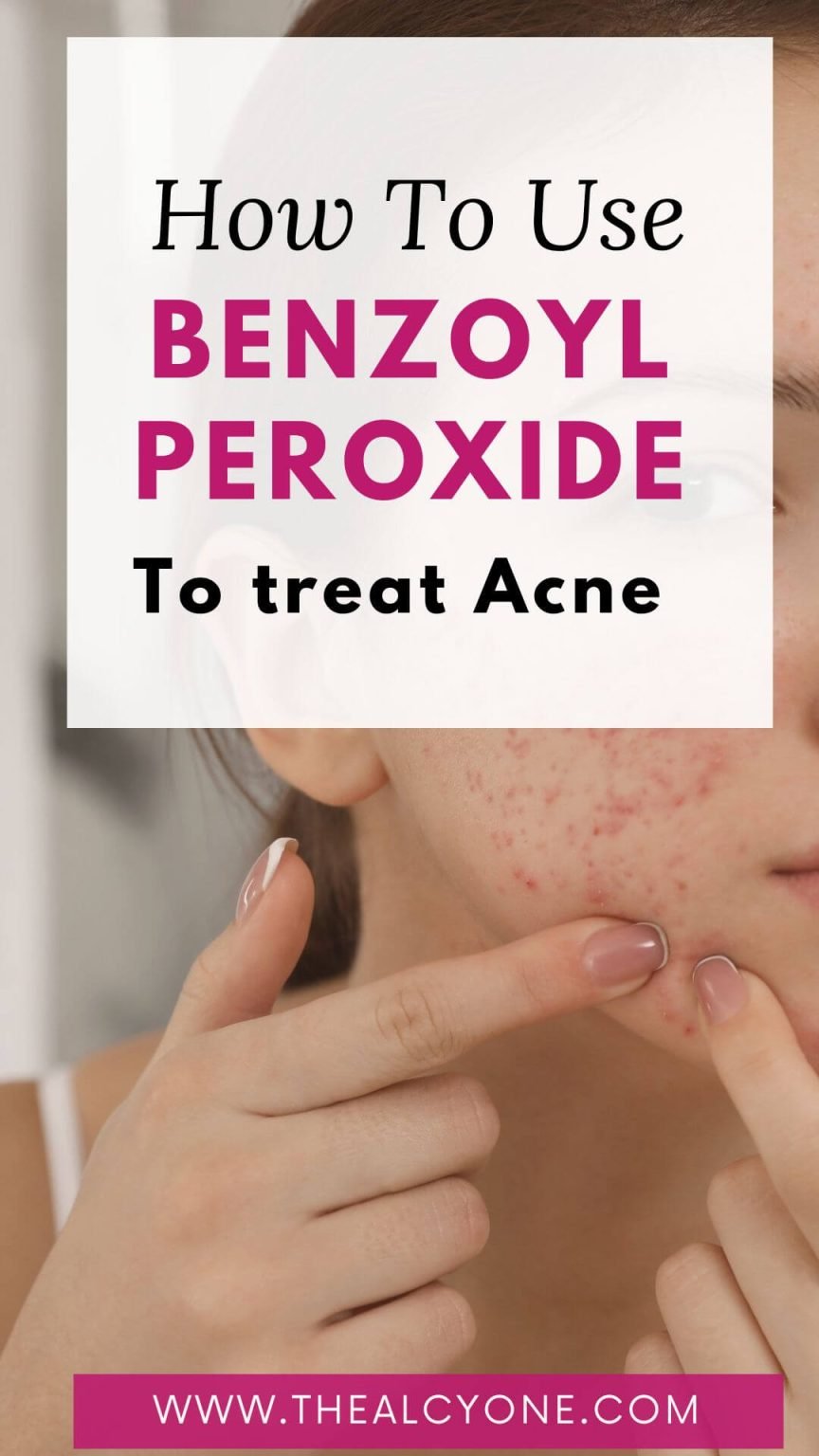 How To Use Benzoyl Peroxide To Treat Acne - The Alcyone