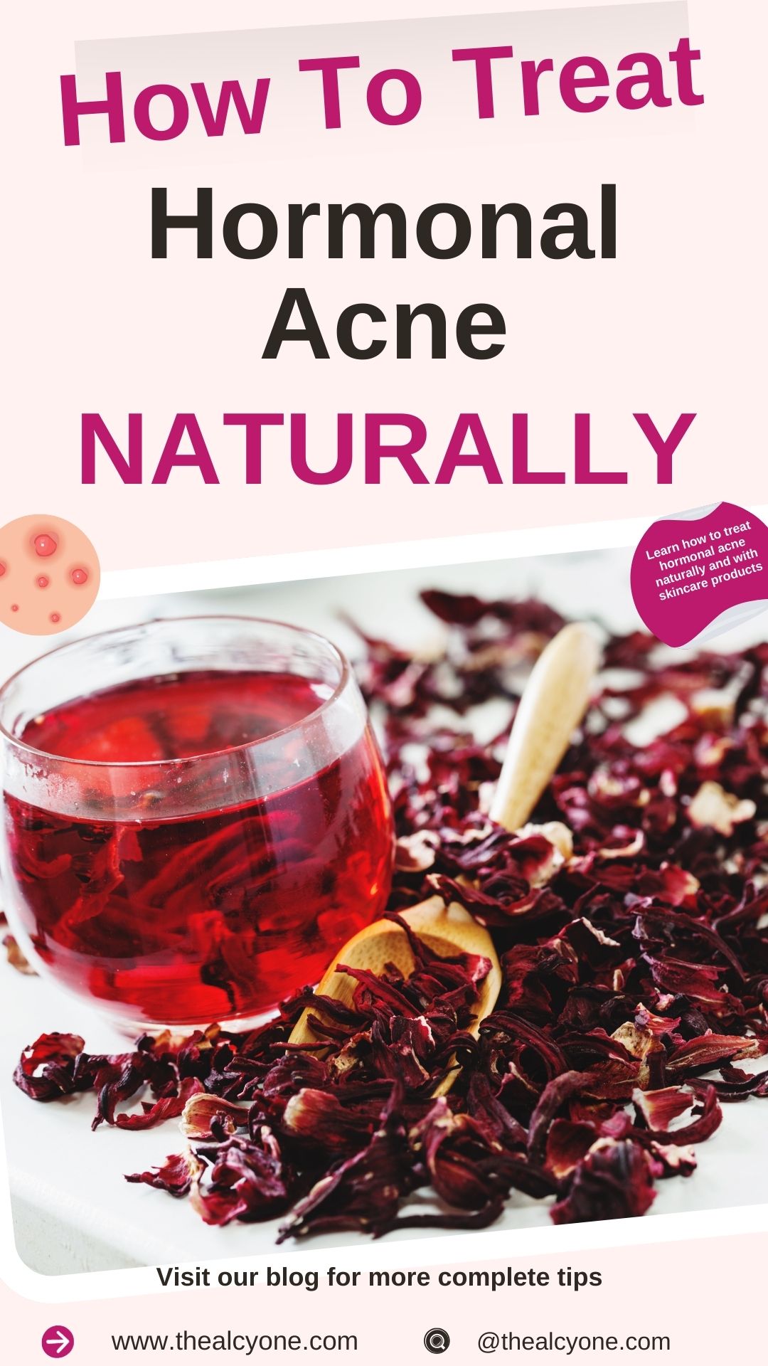 How To Treat Hormonal Acne Naturally And Skincare Products