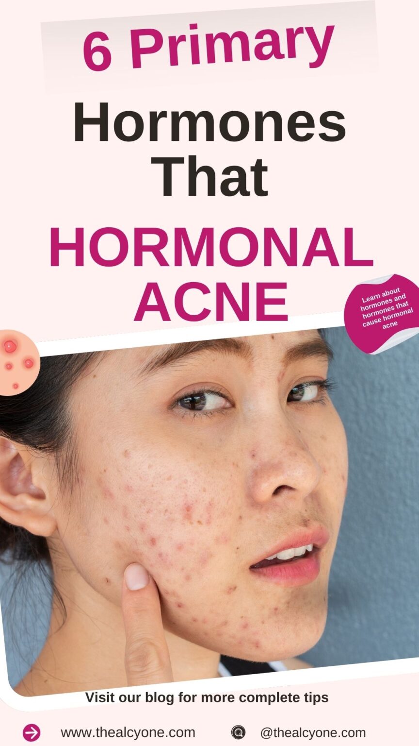 How To Treat Hormonal Acne Naturally & Skincare Products